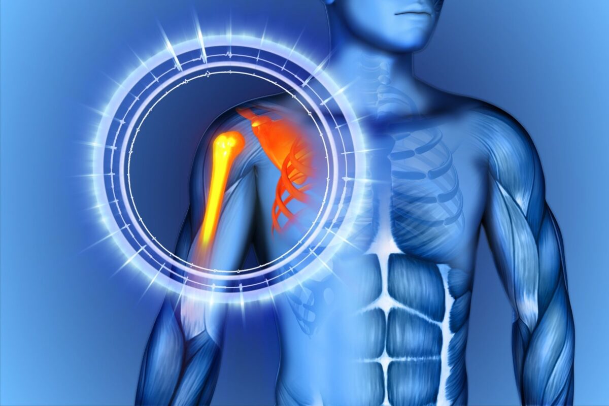Struggling to Lift Your Arm? What It Means and How to Find Relief ...
