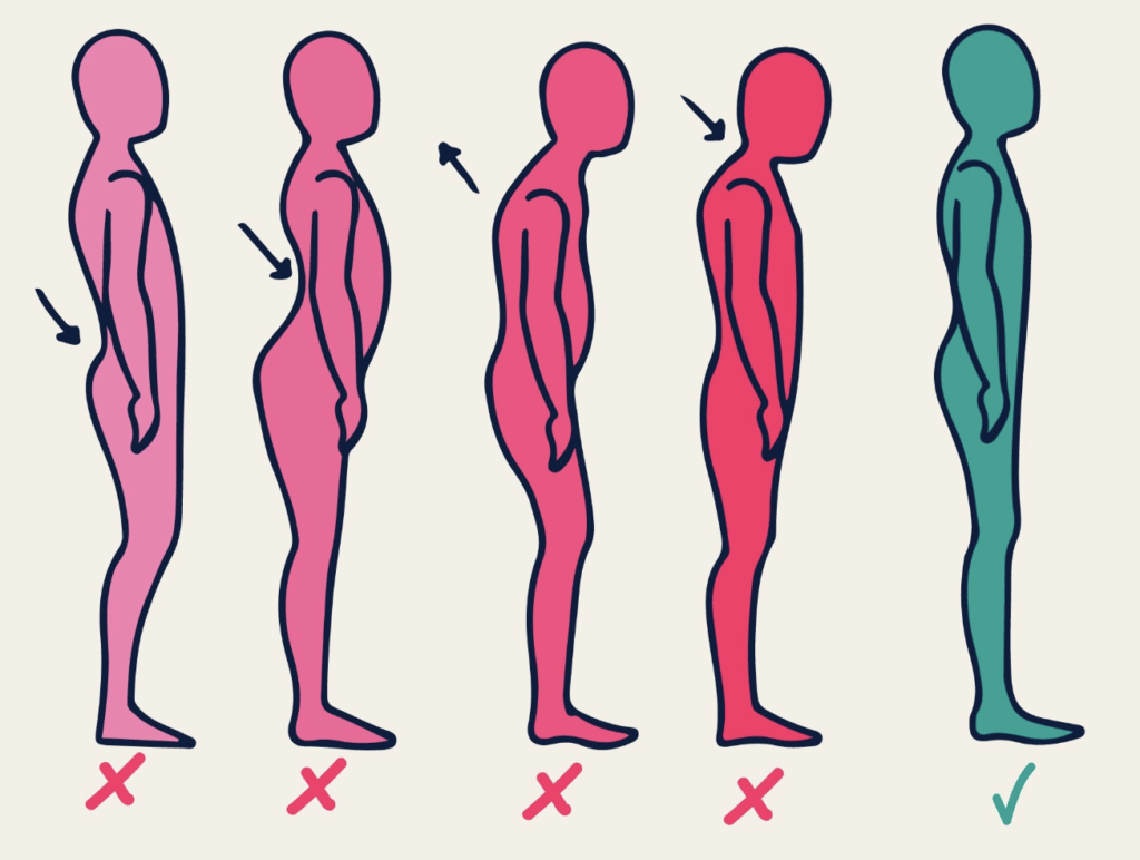 Obsessed with Fixing 'Anterior Pelvic Tilt'? Why TikTok's Favorite ...
